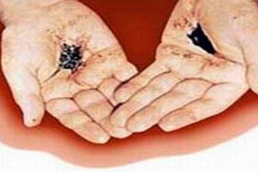 Piane Crati, compaiono le stimmate sulle mani del mistico Mancuso?